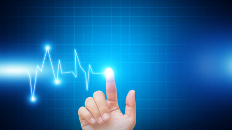 Beyond Spreadsheets: The Resource Management Maturity Model | Retain ...